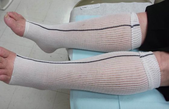 Blog - Page 3 of 3 - Quart Medical Inc.